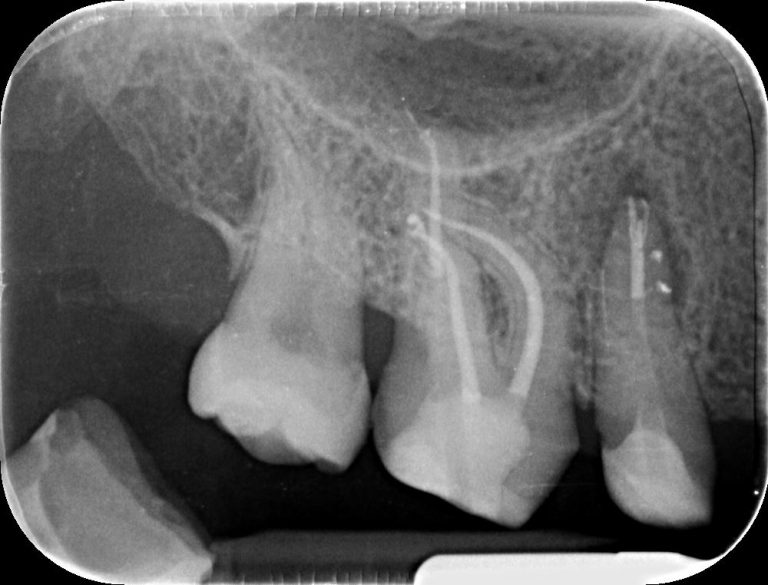 Endodontie – ArtStomatologica